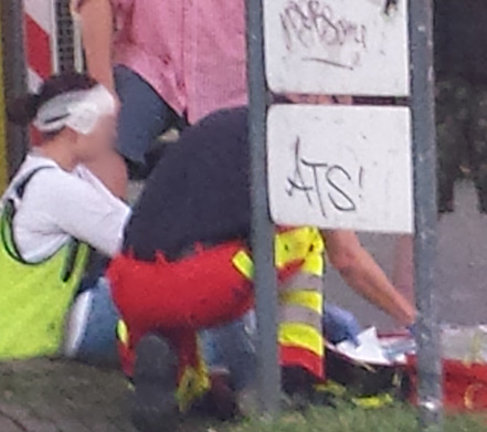 Platzwunde am Kopf nach Sturz auf das Pflaster